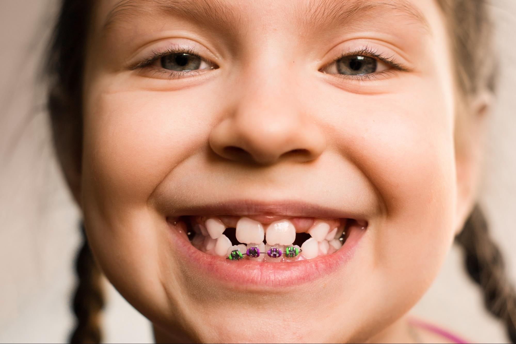Orthodontics for Kids and Teens | Lexington Braces | Coppe + Sears